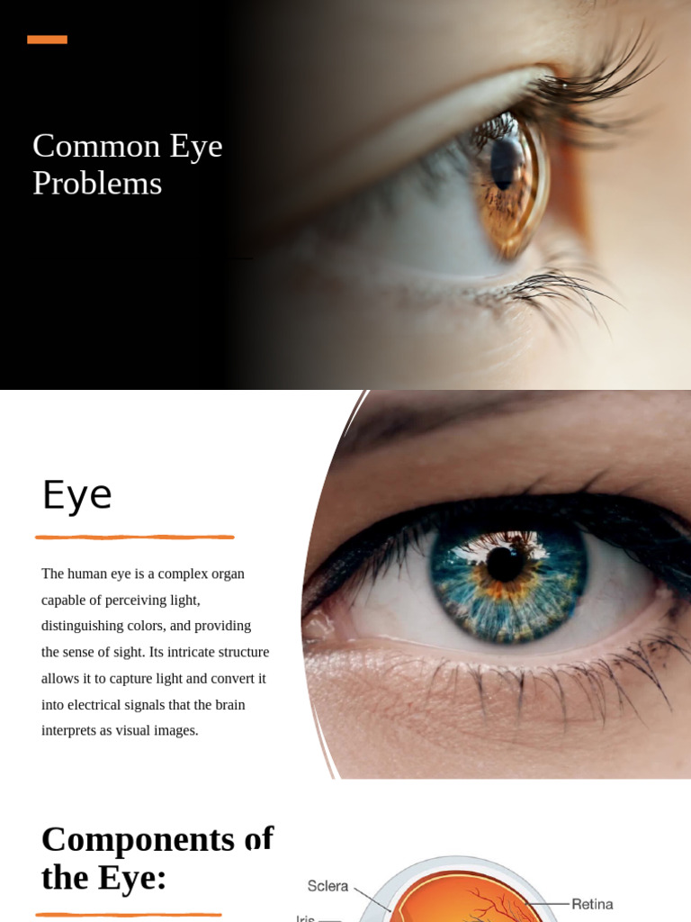 Common Eye Problems | PDF