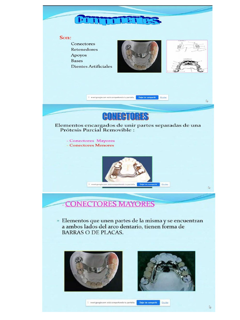 Componentes PPR | PDF