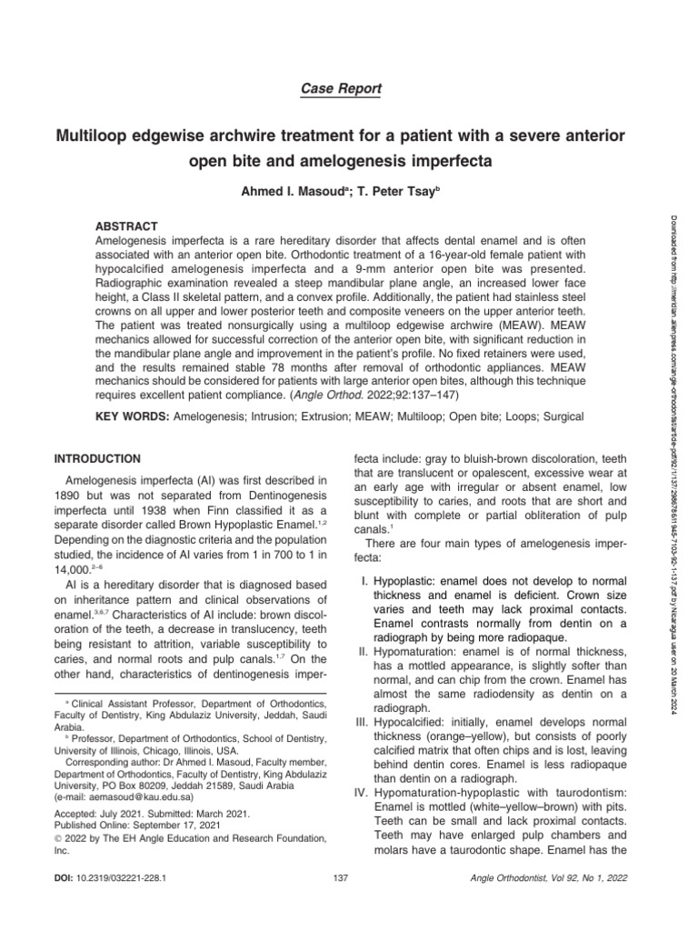 Multiloop Edgewise Archwire Treatment For A Patient With A Severe ...