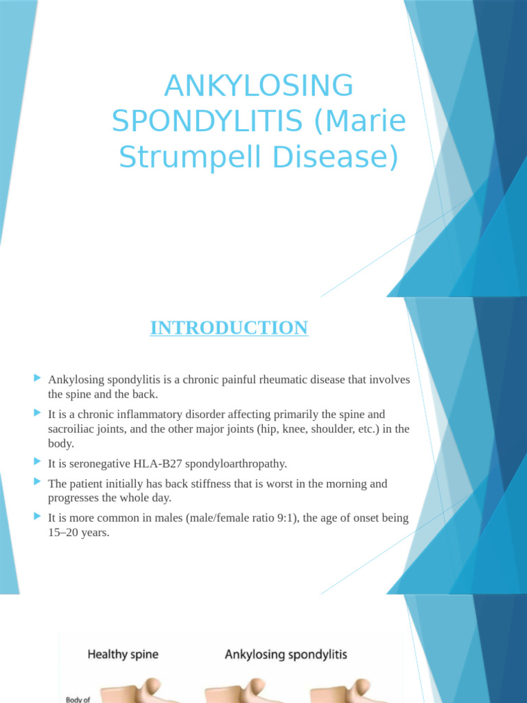 Ankylosing Spondylitis | PDF