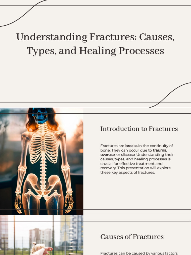 Slidesgo Understanding Fractures Causes Types and Healing Processes 20240913050855SQ39 | PDF