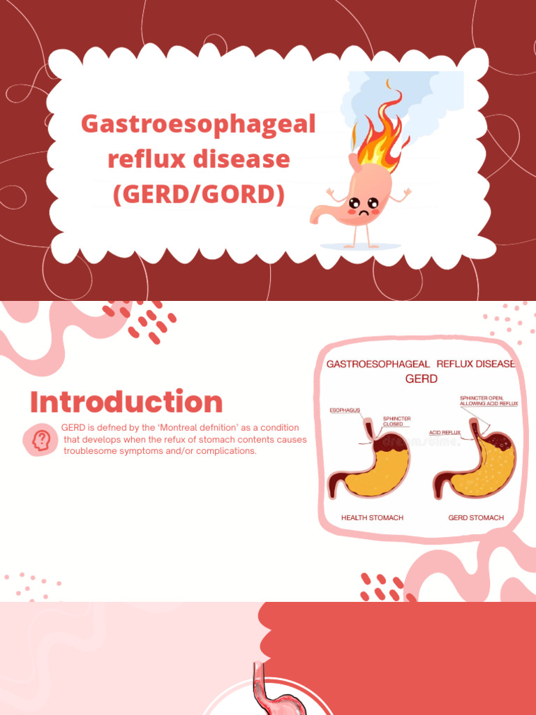 Gerd | PDF