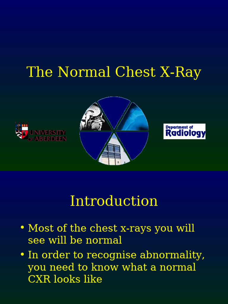 Normal Xray | PDF