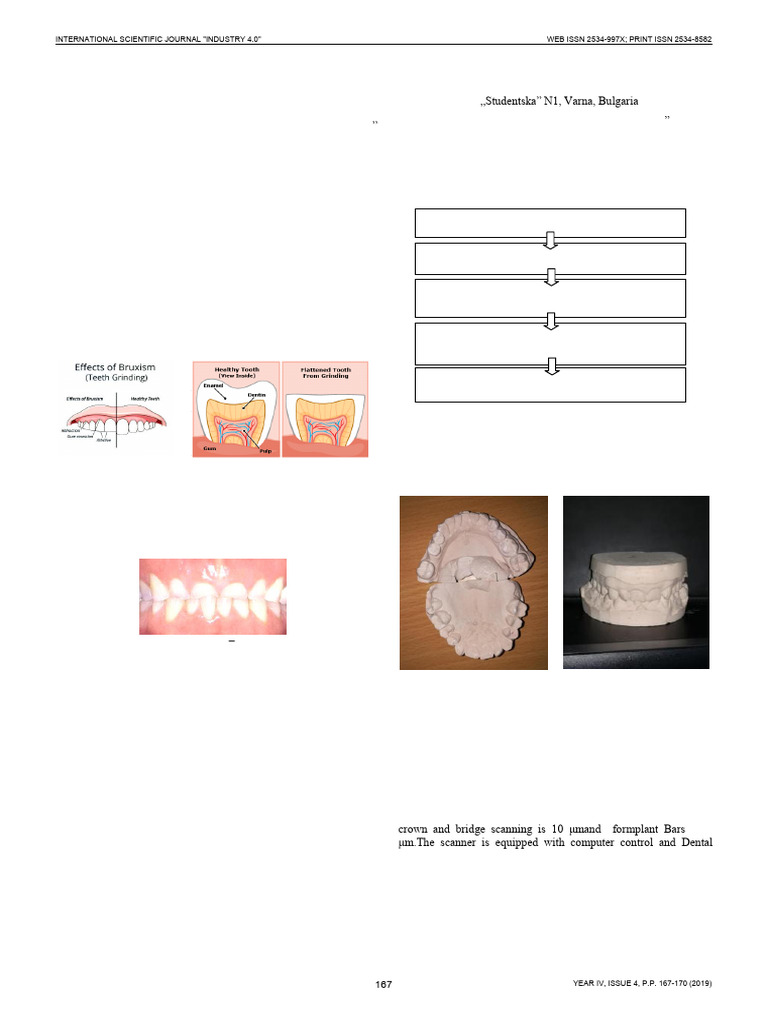 Bruxizm i4-2019!4!167 Creating a 3D Model of Dental Splint for Bruxism | PDF