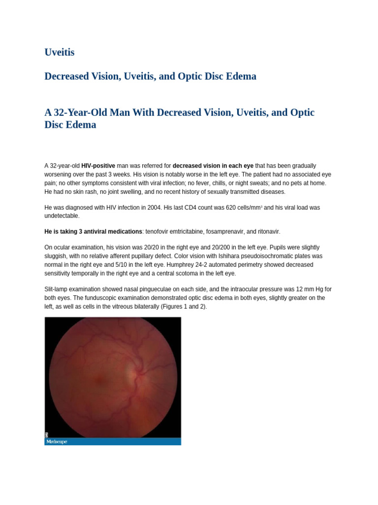 Uveitis Medscape | PDF