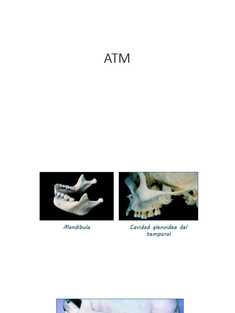 Atm | PDF