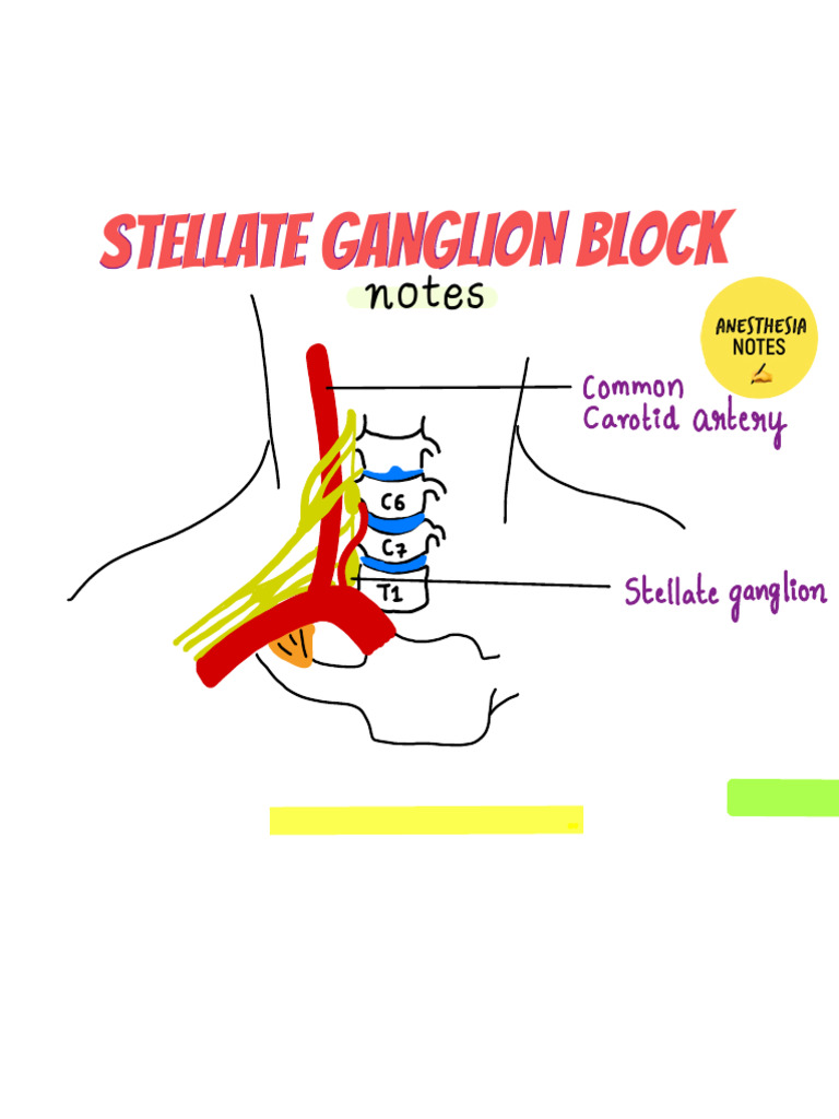 Stellate Ganglion Block Notes | PDF
