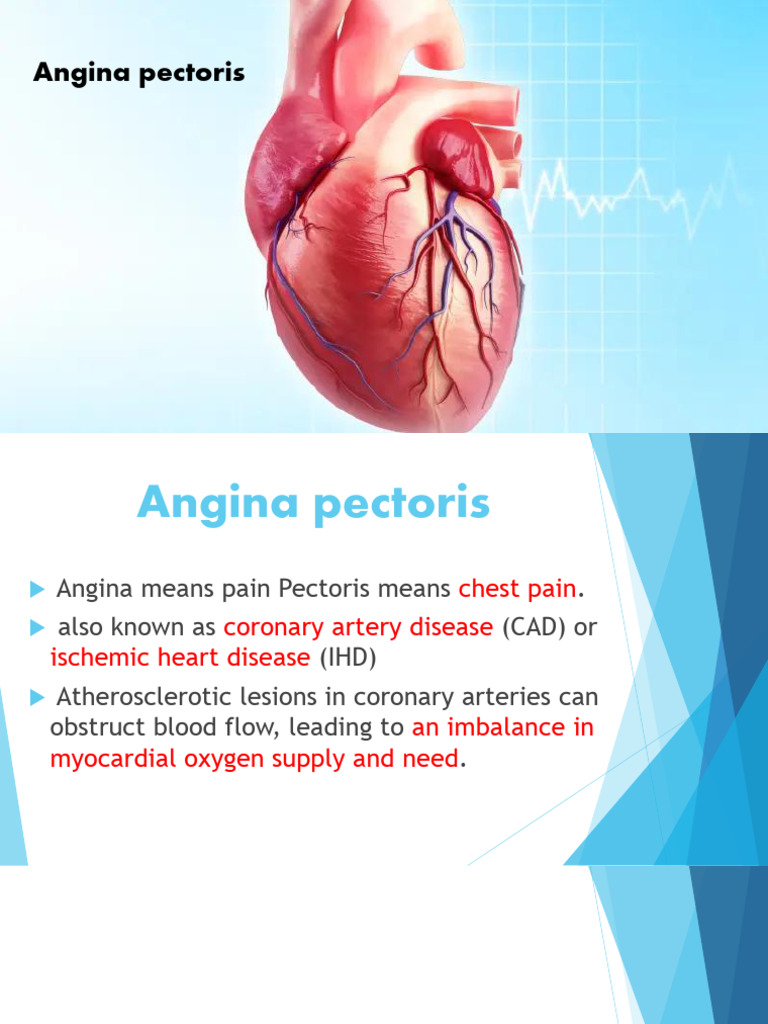 Angina Final | PDF