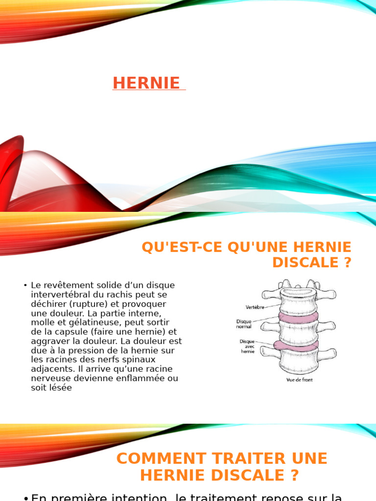 Hernie Discale | PDF