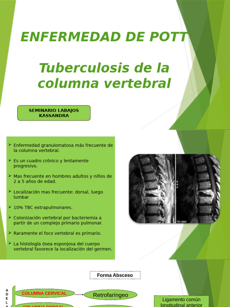 ENFERMEDAD DE POTT | PDF