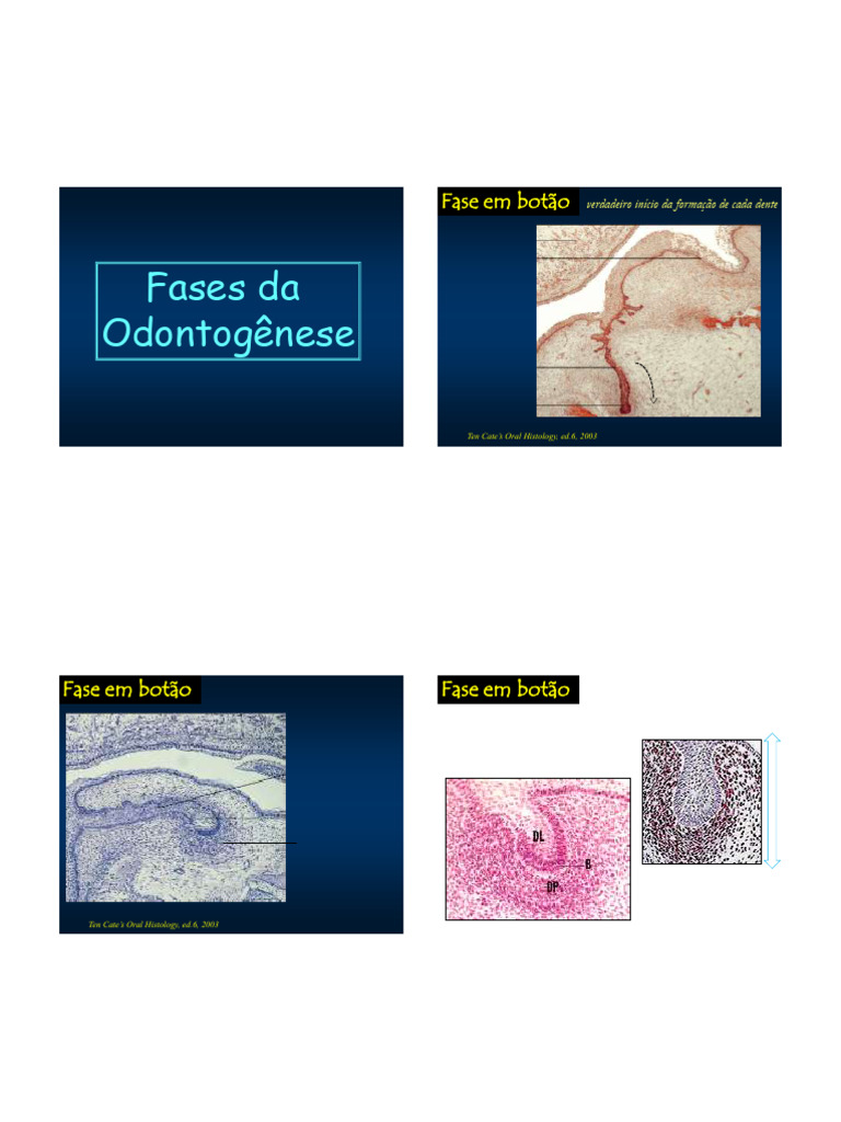Aula Odontogênese - Parte 2 | PDF
