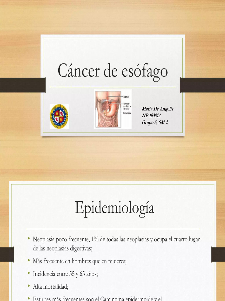 TEMA 03-Cancer Esofagico Clase 4 | PDF