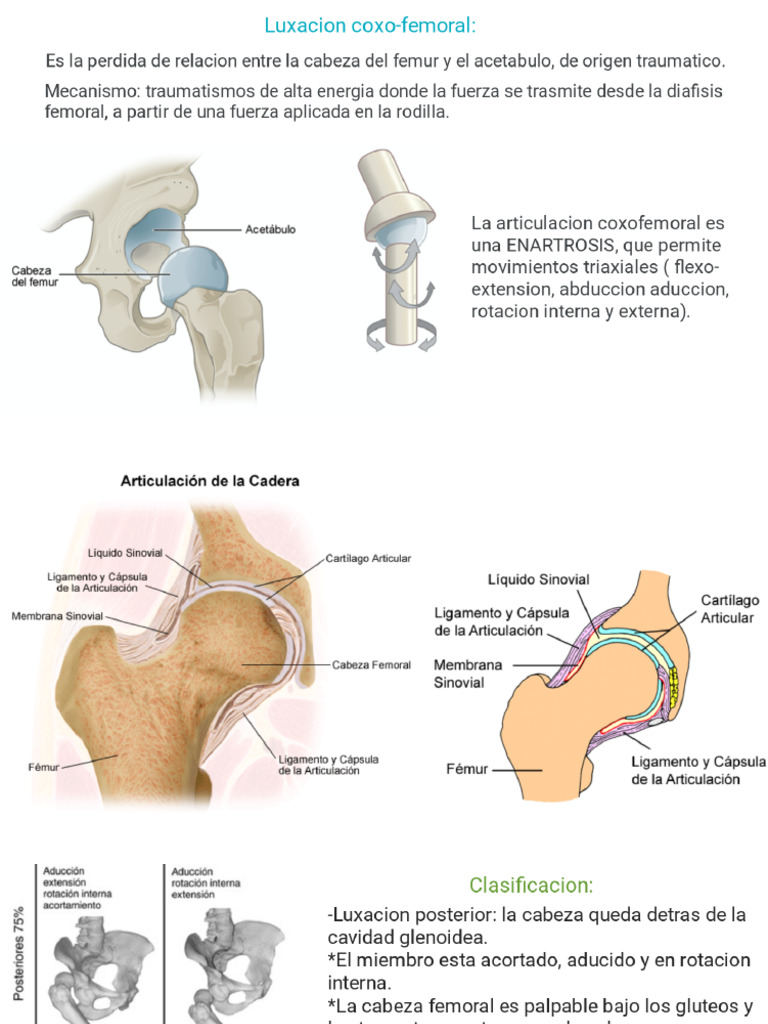 Luxación de Cadera (1) | PDF