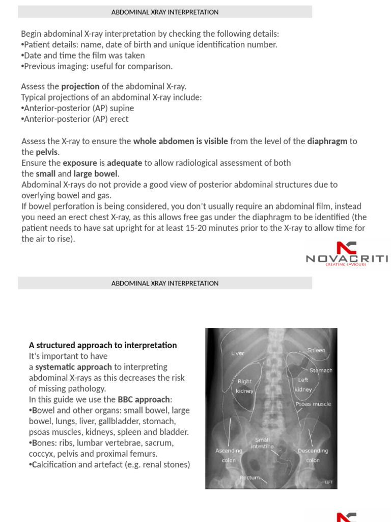 Abdominal Xray | PDF