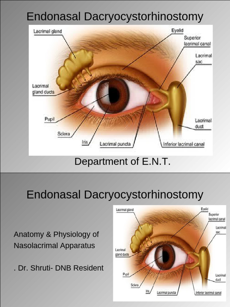 Endonasal DCR | PDF
