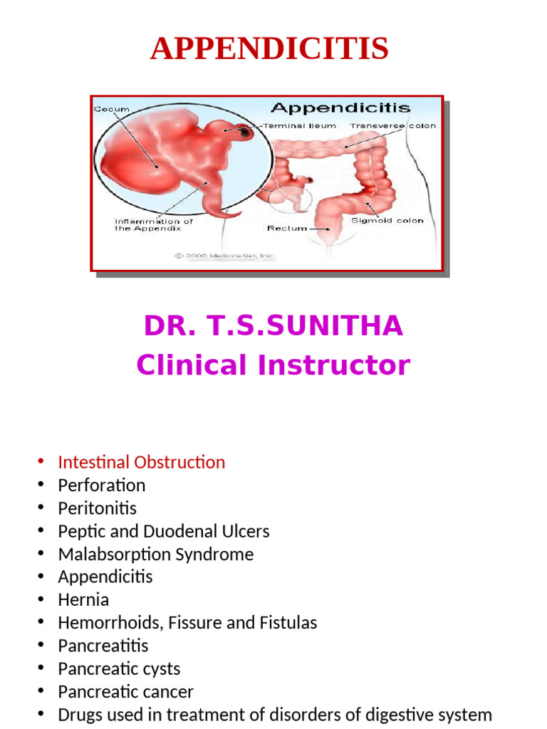 Appendicitis 2024 | PDF
