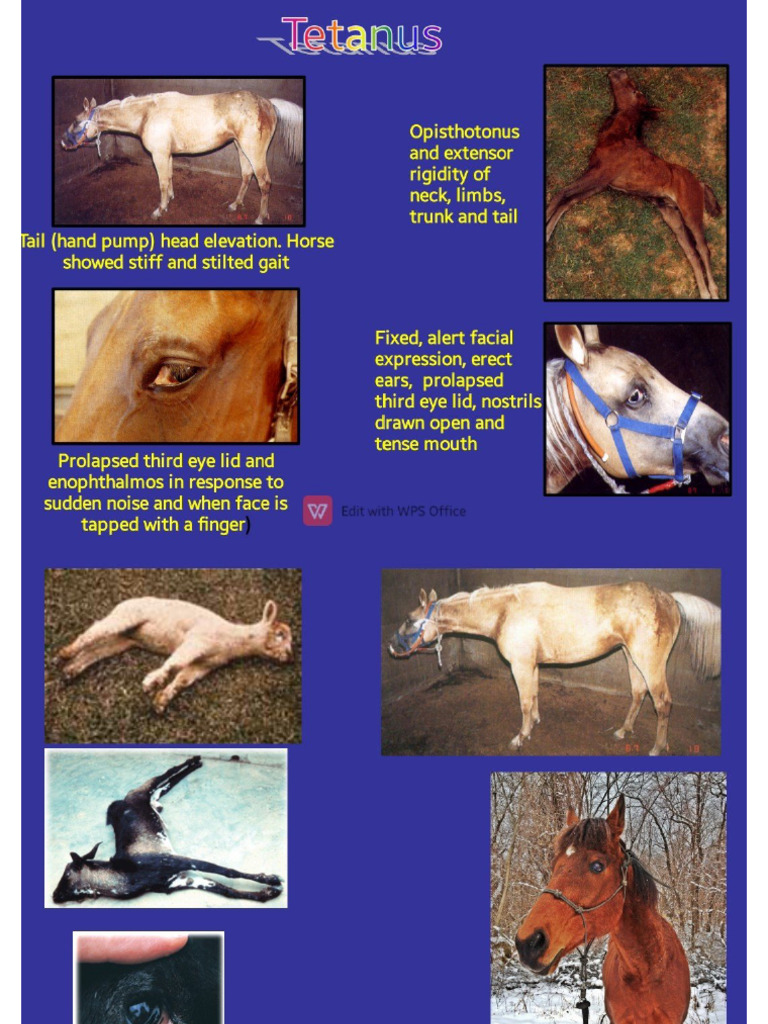 Tetanus | PDF