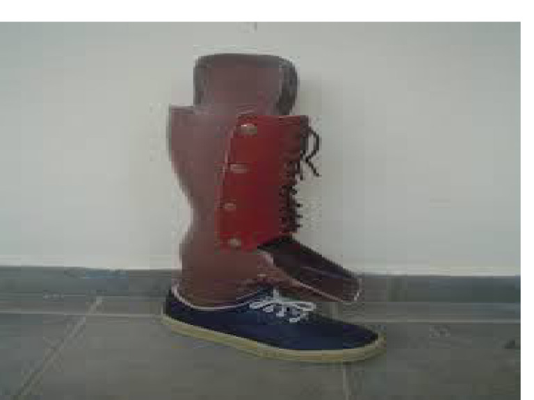 Orthoprosthesis | PDF