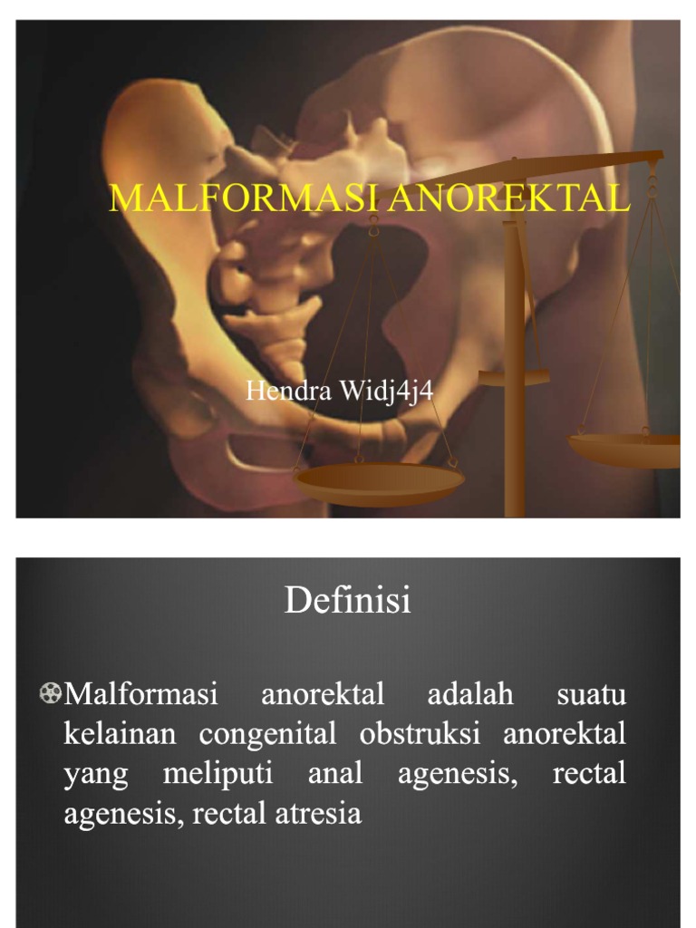 Malformasi Anorektal | PDF