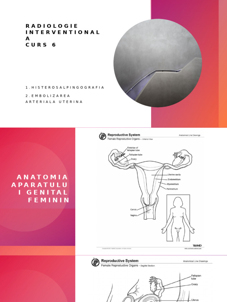 Histerosalpingografie Si Embolizare Arteriala | PDF