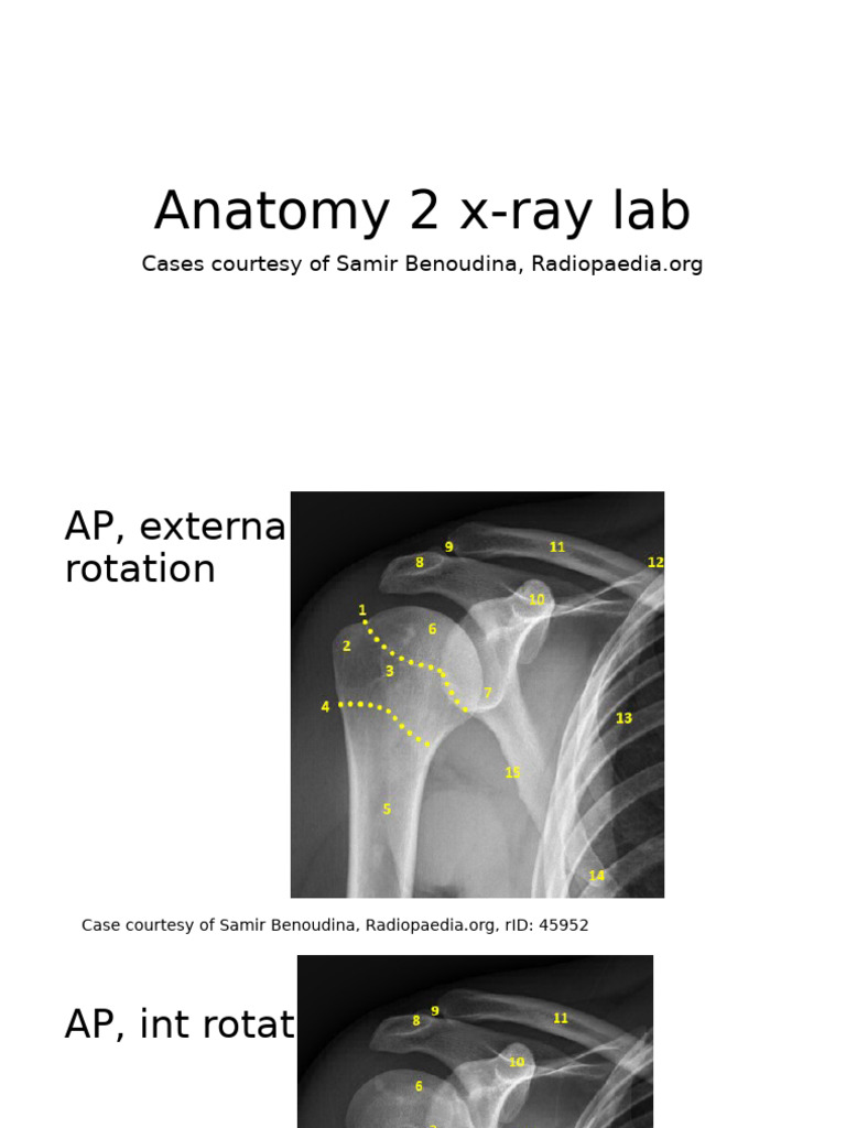 Anatomy 2 X-Ray Lab | PDF