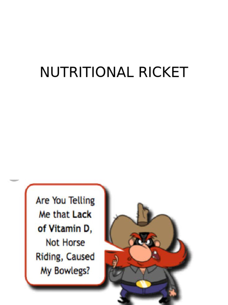 Nutritional Ricket | PDF