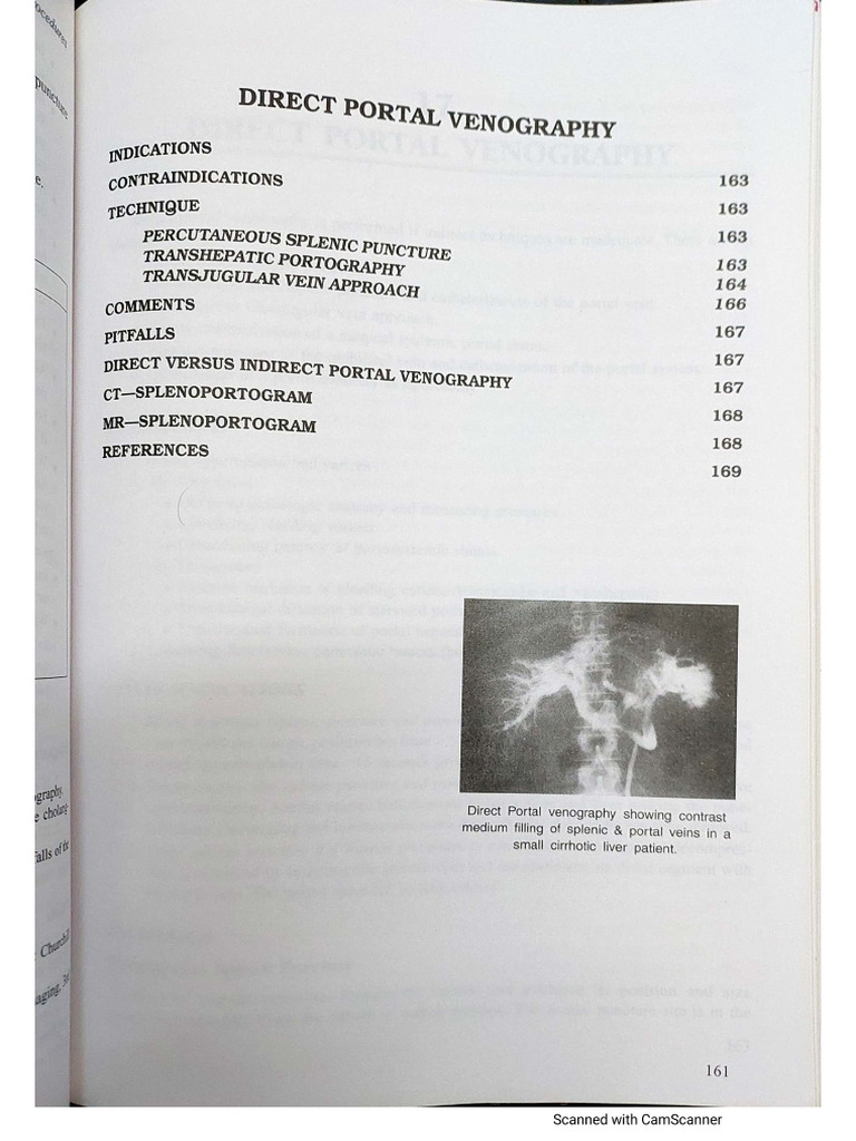 Direct Portal Venography | PDF