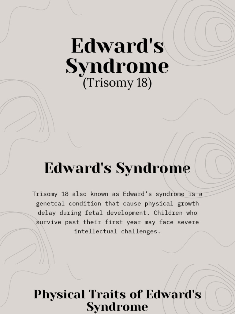 Edward's Syndrome - 20240919 - 170355 - 0000 | PDF