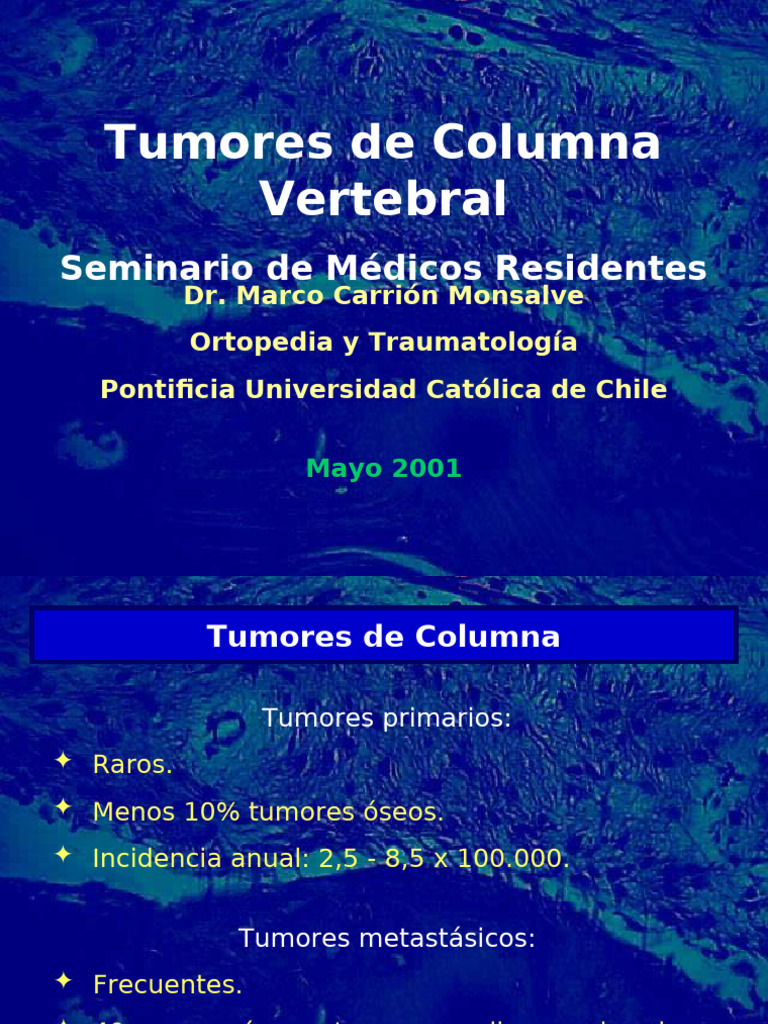 Tumores de Columna | PDF