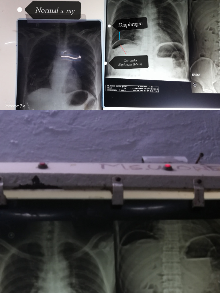 X Ray Surgery, SP's File | PDF