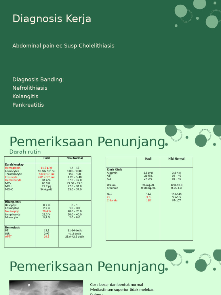 Cholelithiasis | PDF