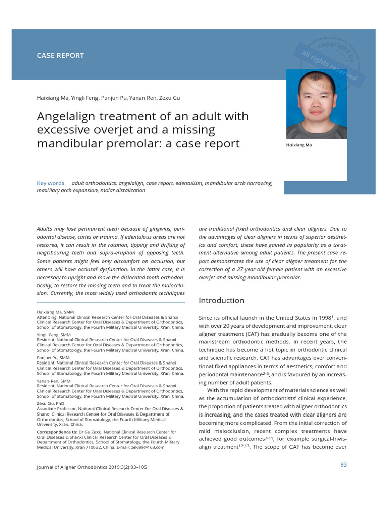 Angelalign Treatment of An Adult With Excessive Overjet and A Missing ...