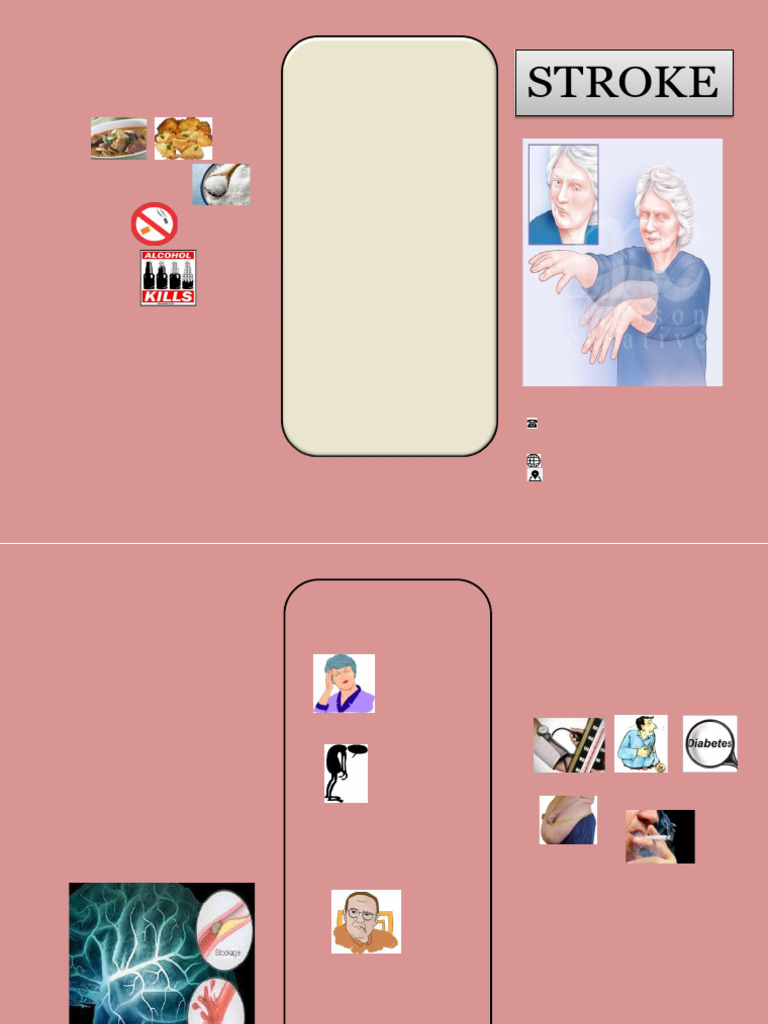 Leaflet Stroke | PDF