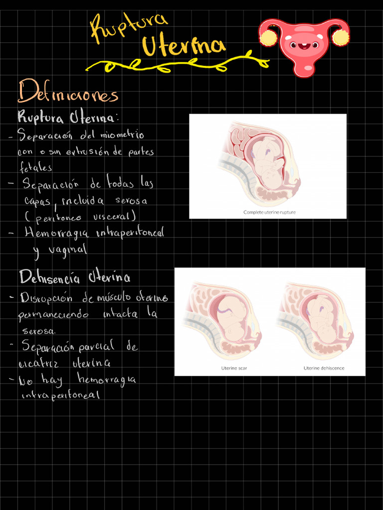 36 Ruptura Uterina - 230613 - 211001 | PDF