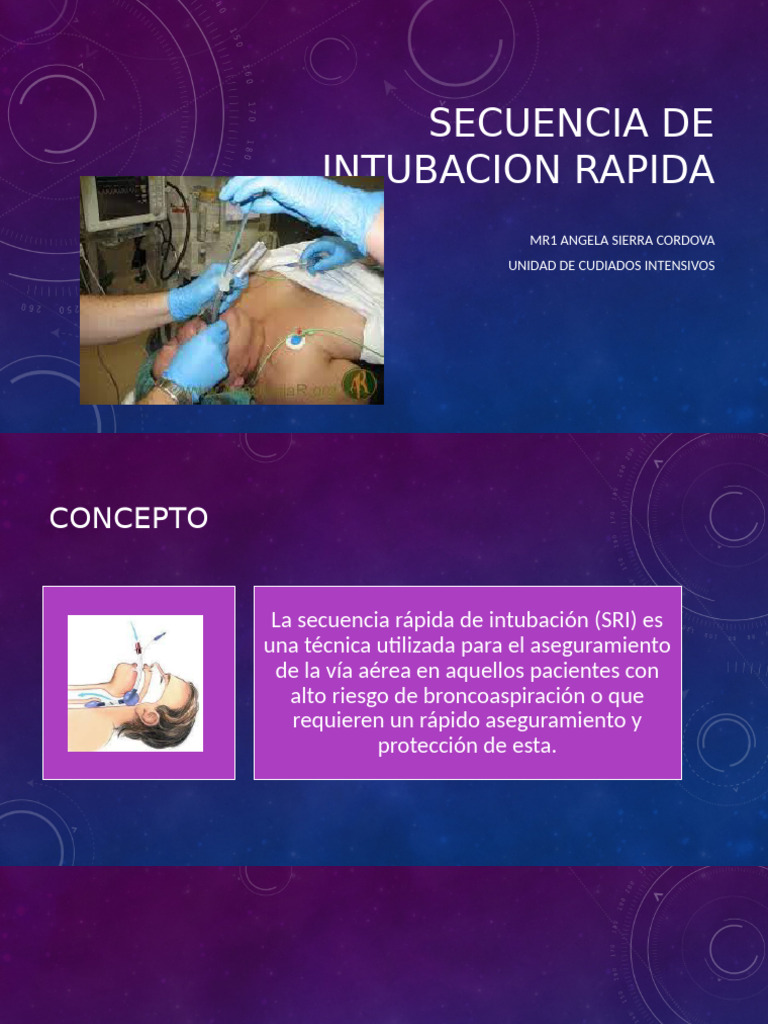 Secuencia de Intubacion Rapida | PDF