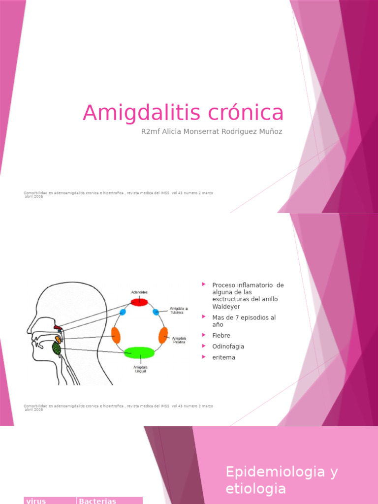 Amigdalitis Cronica | PDF
