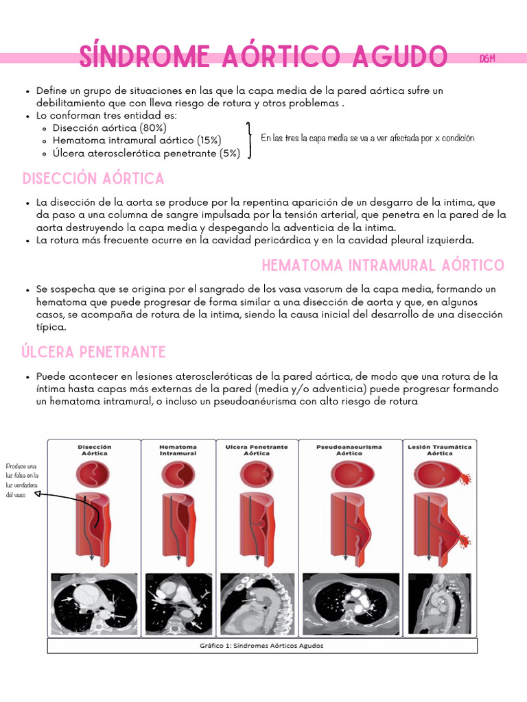 7 - SD Aórtico Agudo Dr. Ugalde | PDF