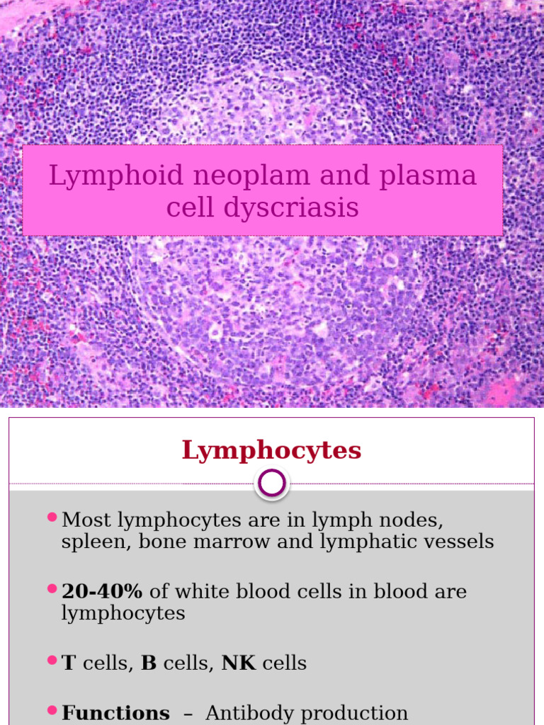 Lymphoma | PDF