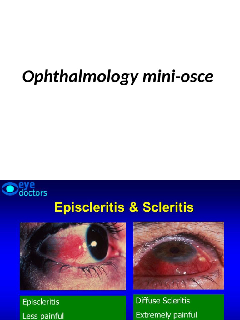 Ophthalmology Mini Osce | PDF