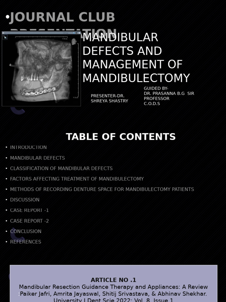 Guided Flange Prosthesis | PDF | Dentures | Dental Implant