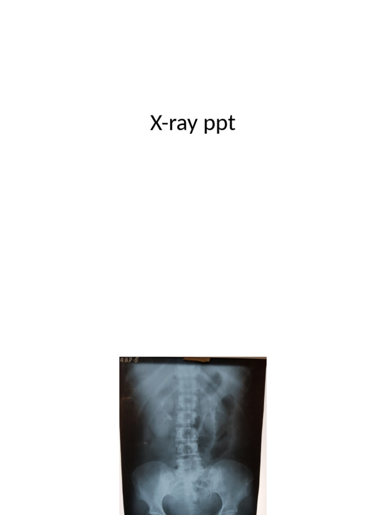 x ray ppt- Viva | PDF