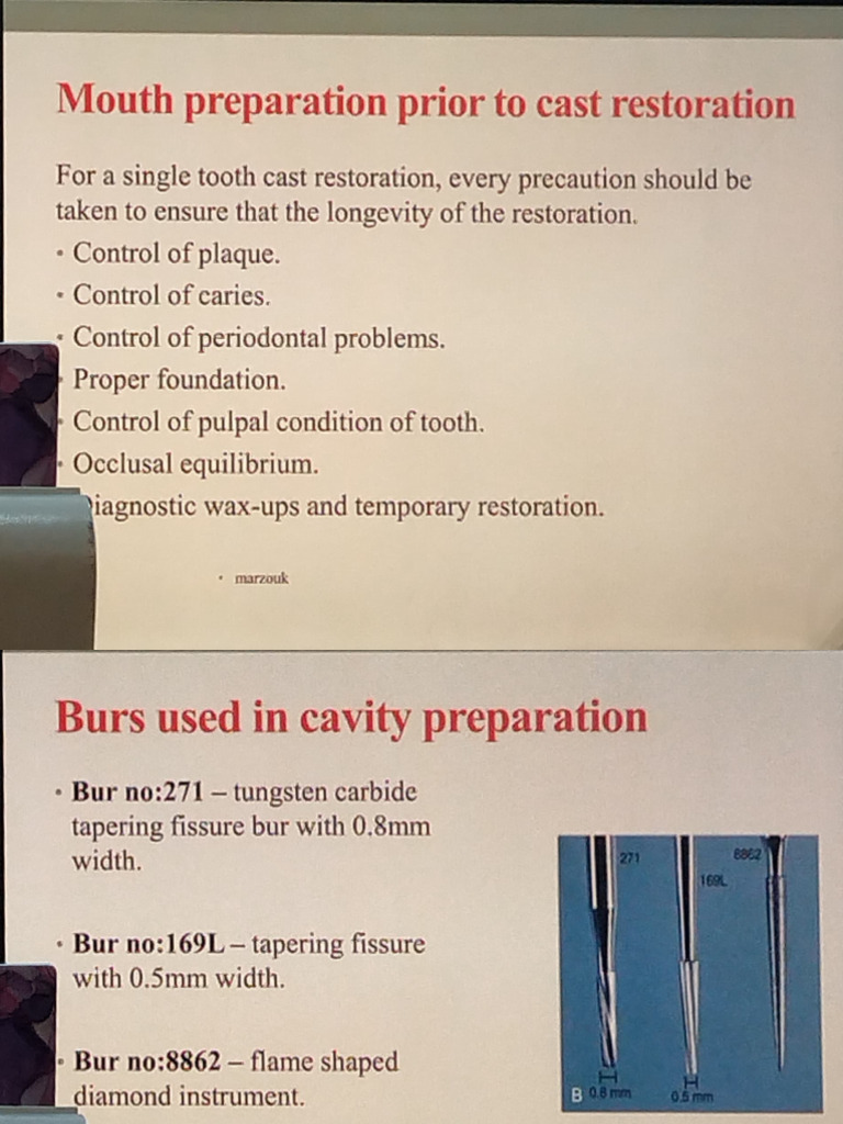 Tooth Preparation for Inlay | PDF