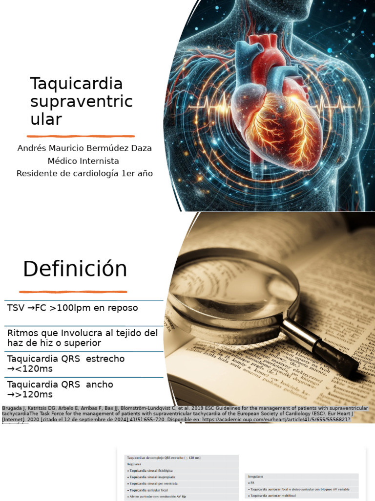 Taquicardia Supraventricular | PDF