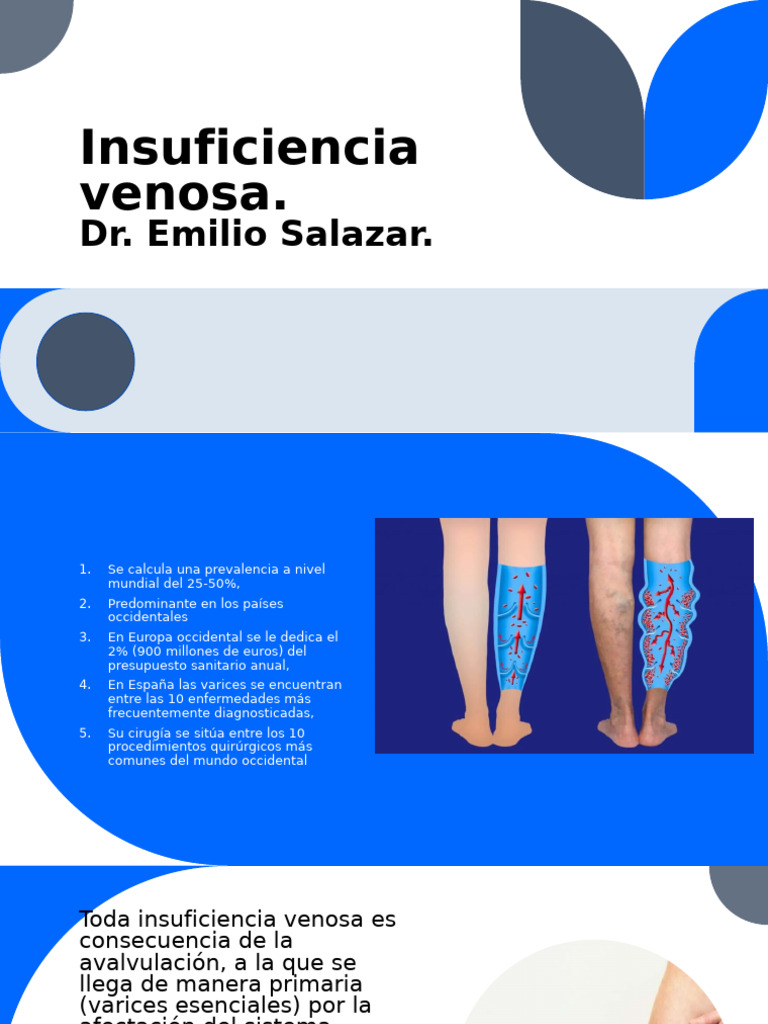 Insuficiencia Venosa | PDF
