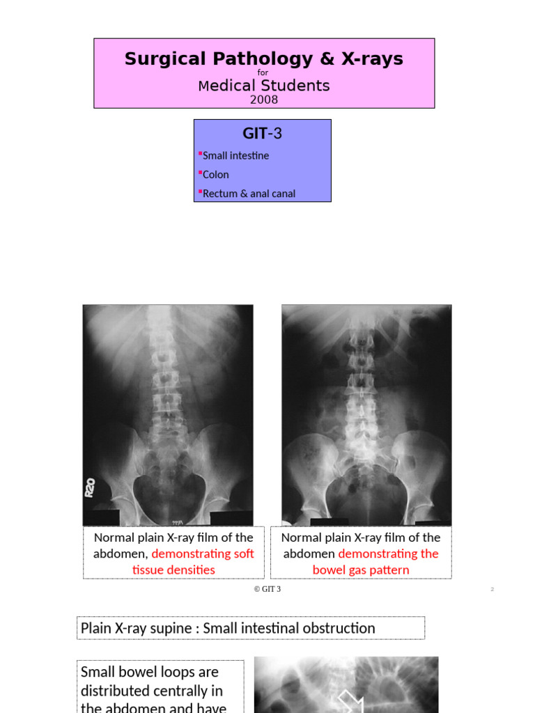 04-Lower GIT Slides 1 | PDF