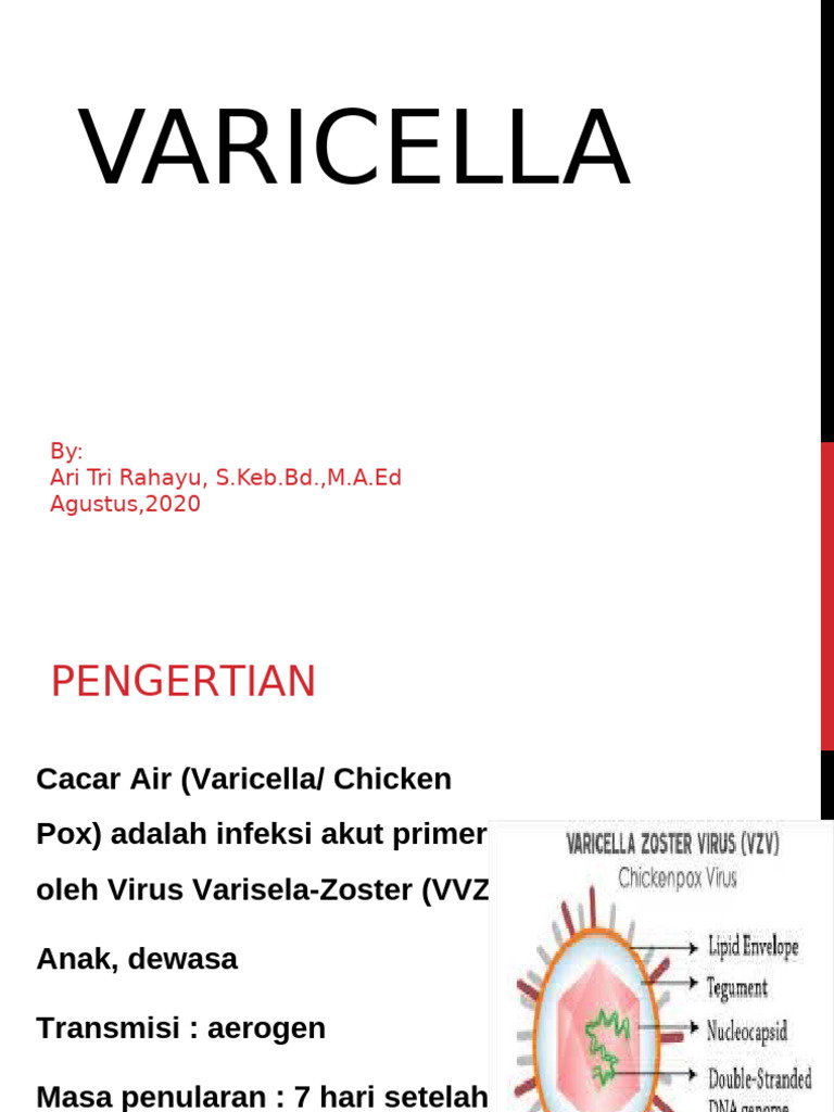 Varicella | PDF