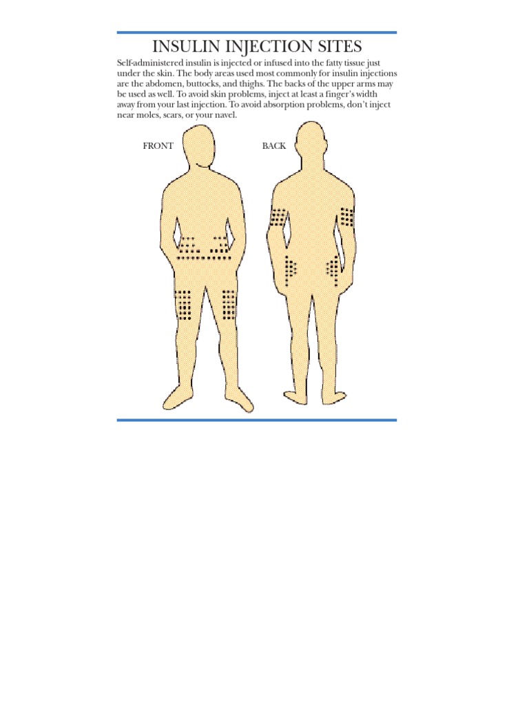 Insulin Injection Sites Overview | PDF | Disorders Of Endocrine ...