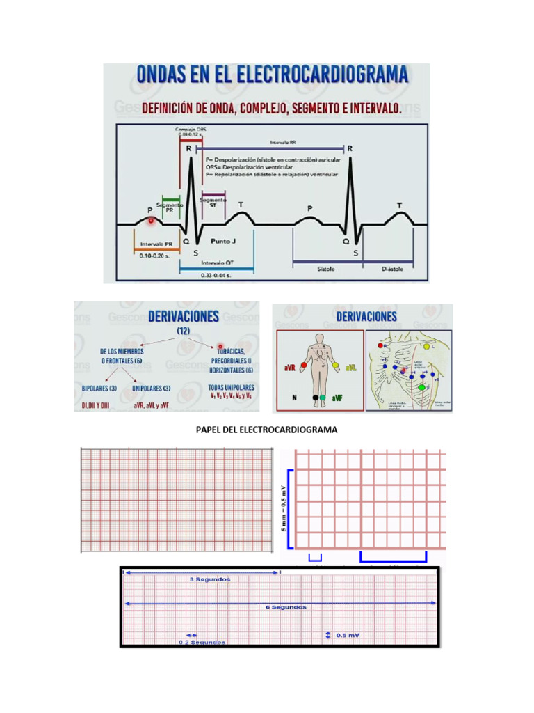 Taller Ekg | PDF | Sains & Matematika
