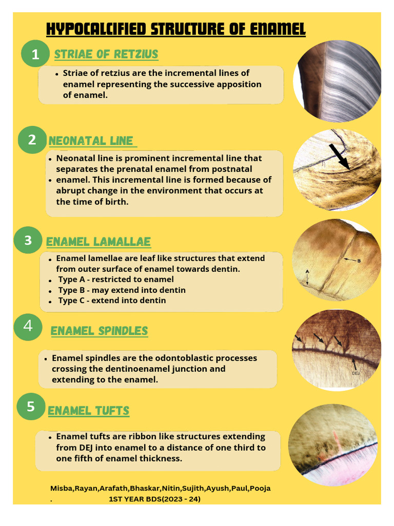 Hypocalcified Structures of Enamel | PDF