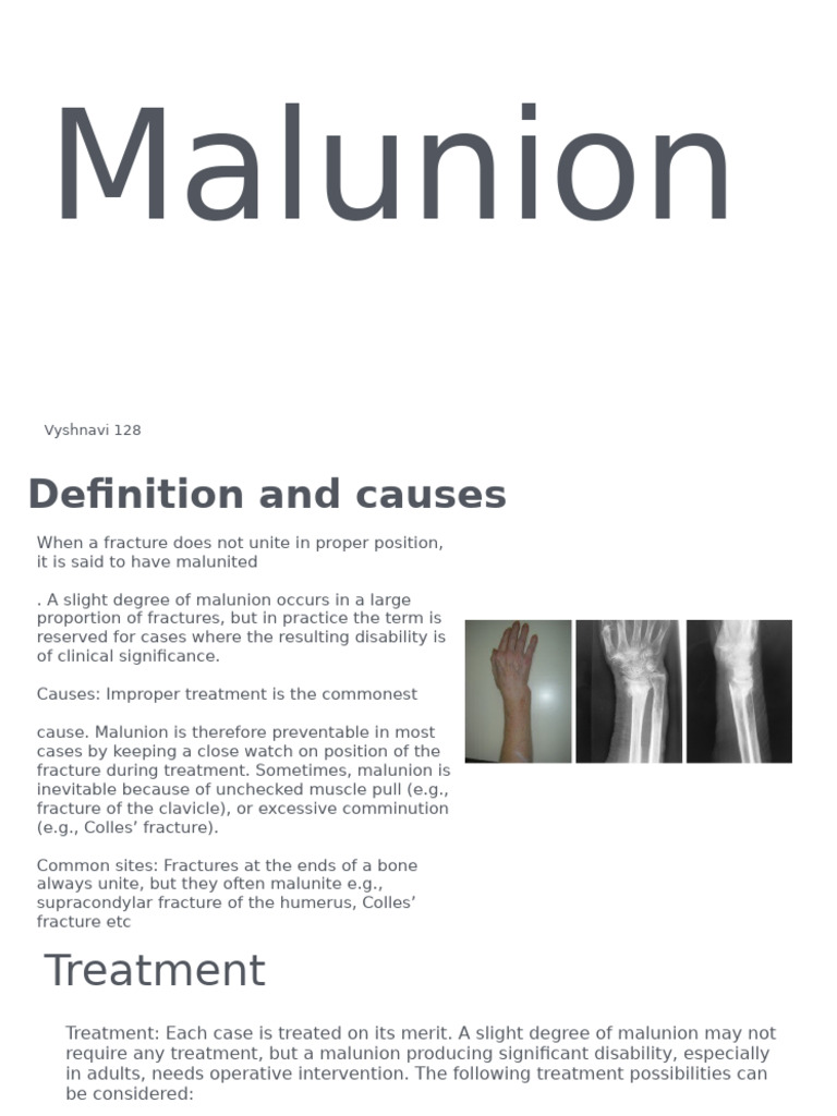 Malunion: Vyshnavi 128 | PDF